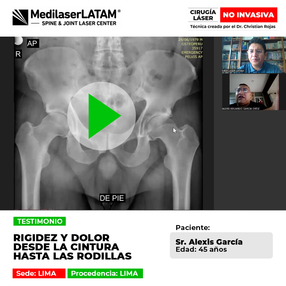 Rigidez y dolor desde la cintura hasta las rodillas | TESTIMONIO